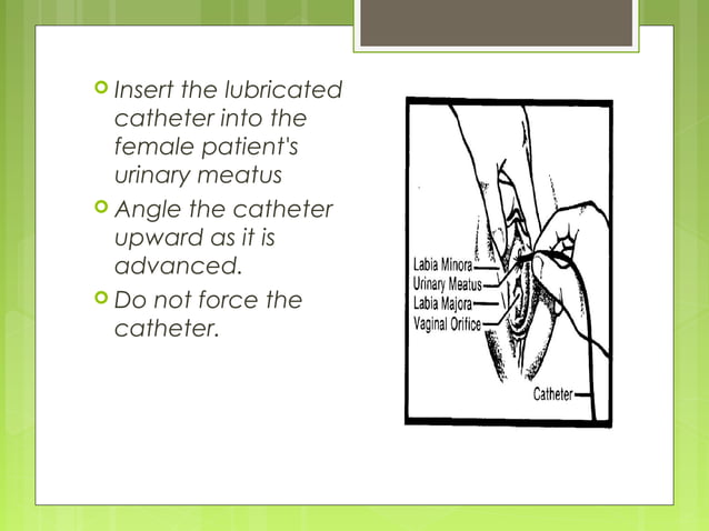 Final urinary bladder catheterisation | PPT | Surgery | Medical Health