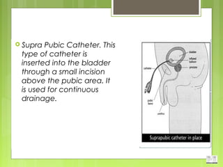Final urinary bladder catheterisation | PPT | Surgery | Medical Health