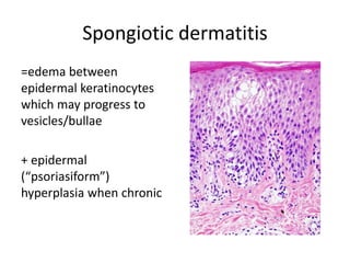 Final version histologic intepretation of bxs for dermatitis | PPT