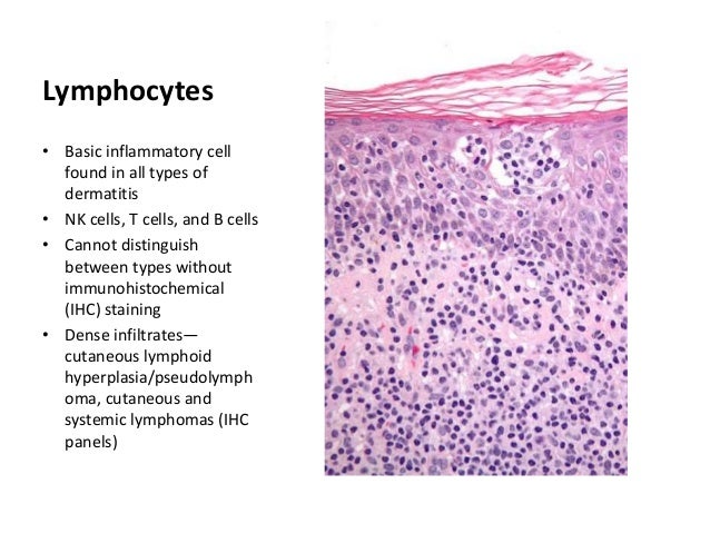 Final version histologic intepretation of bxs for dermatitis