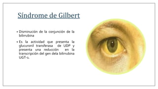 Ictericia y Hiperbilirrubinemia | PPTX