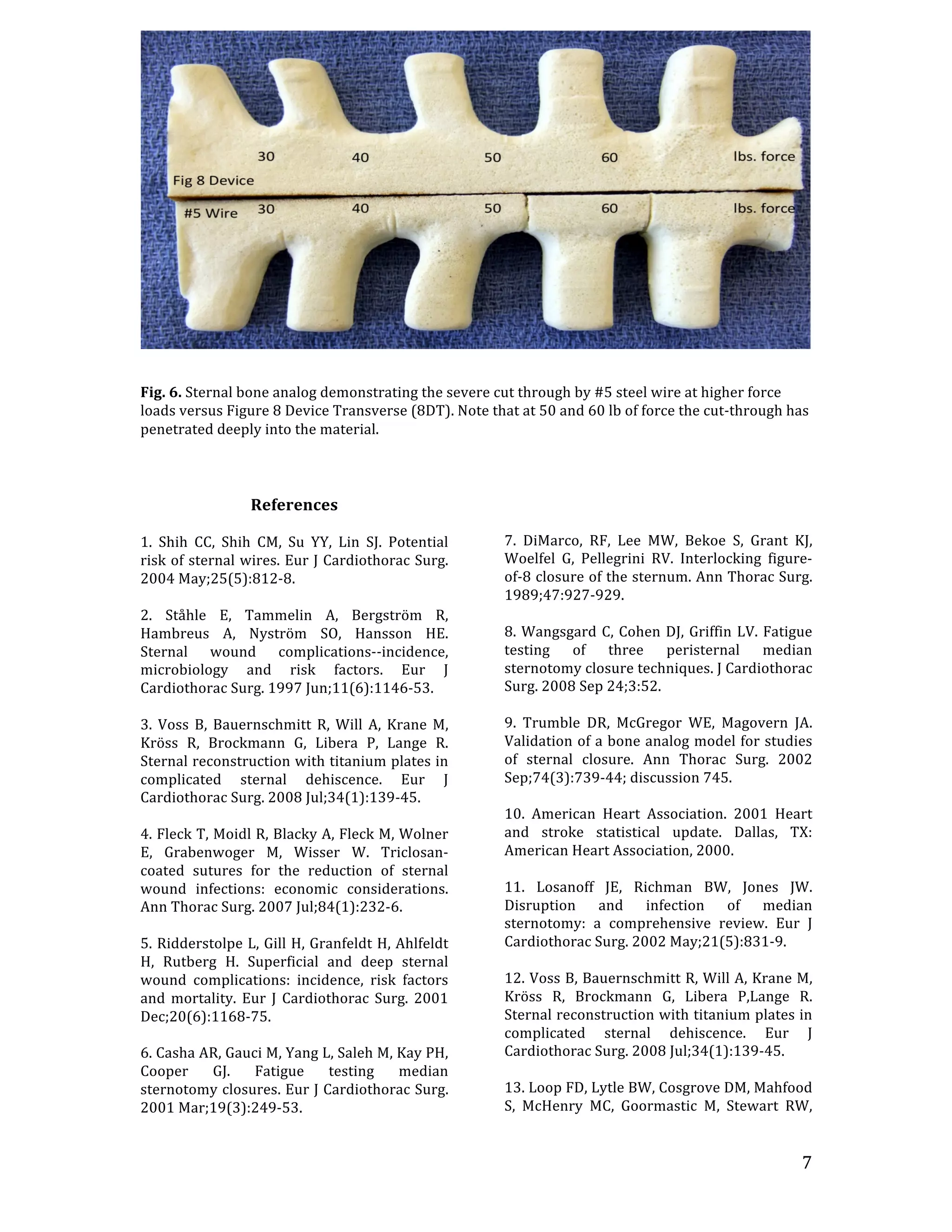 Figure 8 Sternal Closure Device Bench Top | PDF