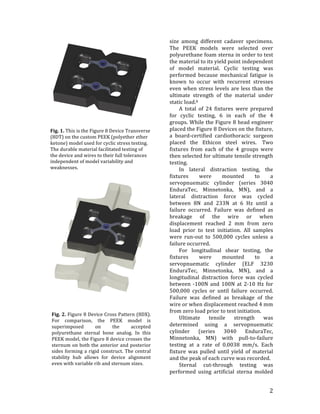 Figure 8 Sternal Closure Device Bench Top | PDF