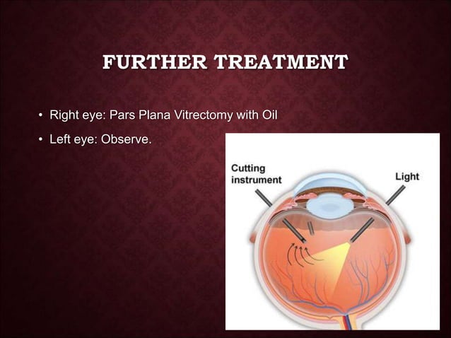 final VHL presentation.ppt | Eye and Vision Conditions | Diseases and ...