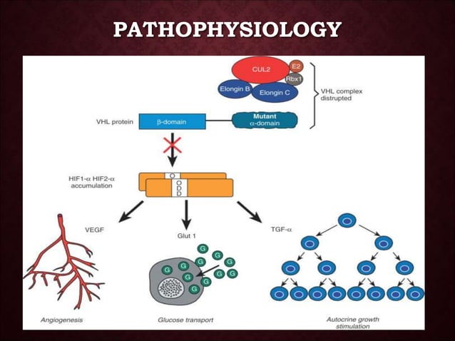 final VHL presentation.ppt | Eye and Vision Conditions | Diseases and ...