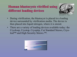Blastocyst Vitrification: State of the Art | PPT