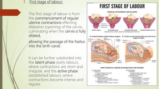 PT IN OBSTETRICS | PPTX