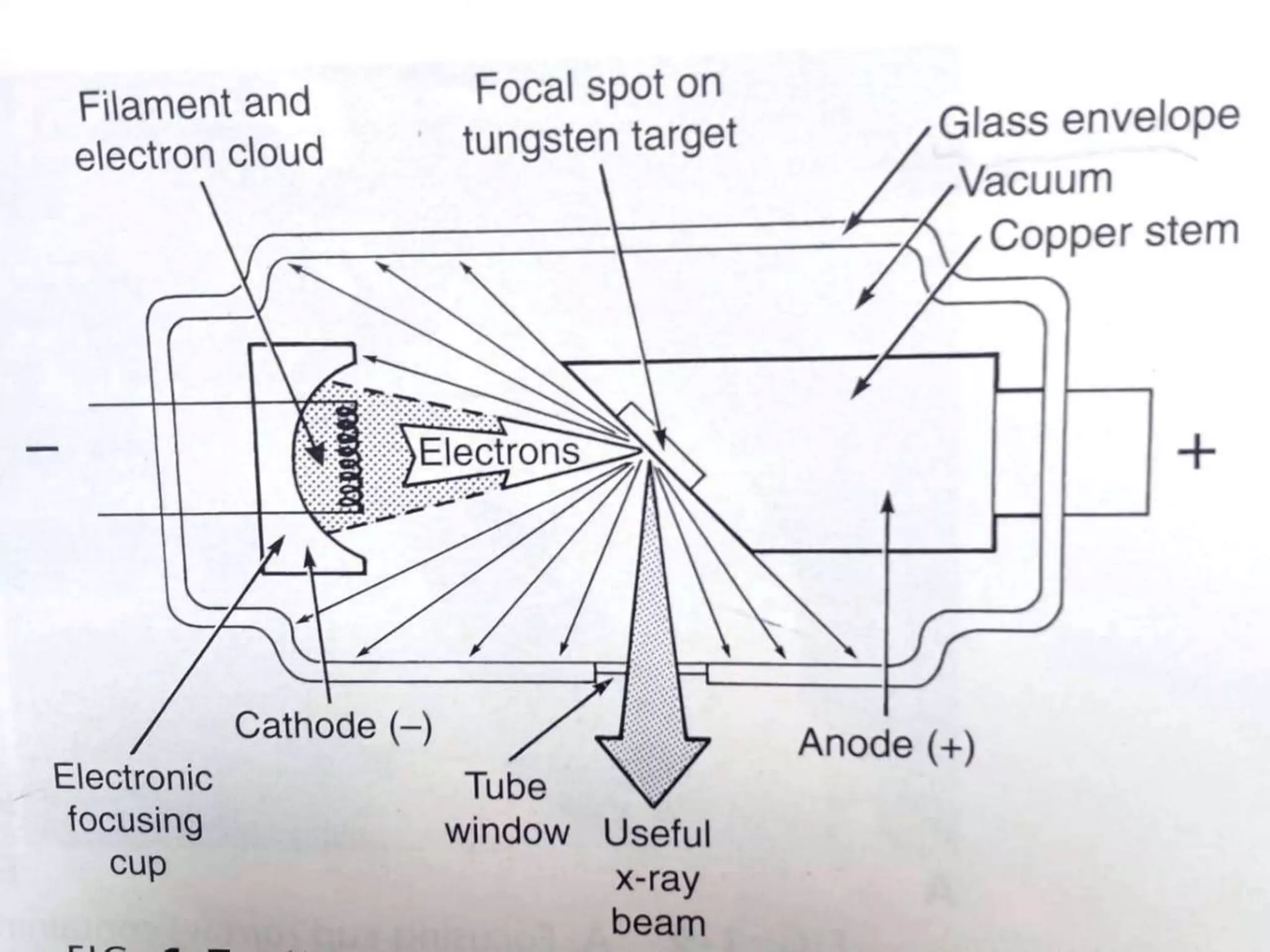 Components of X-Ray Tube | PPTX