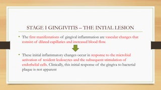 Final year class - gingival inflammation.pptx