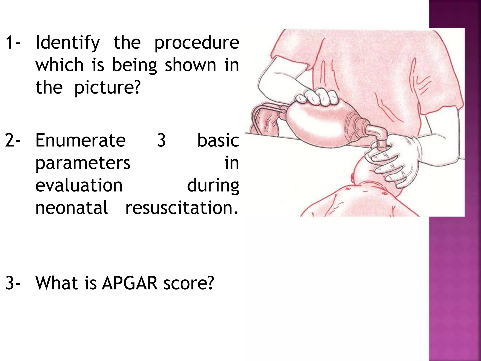 neonatal resuscitation | PPTX