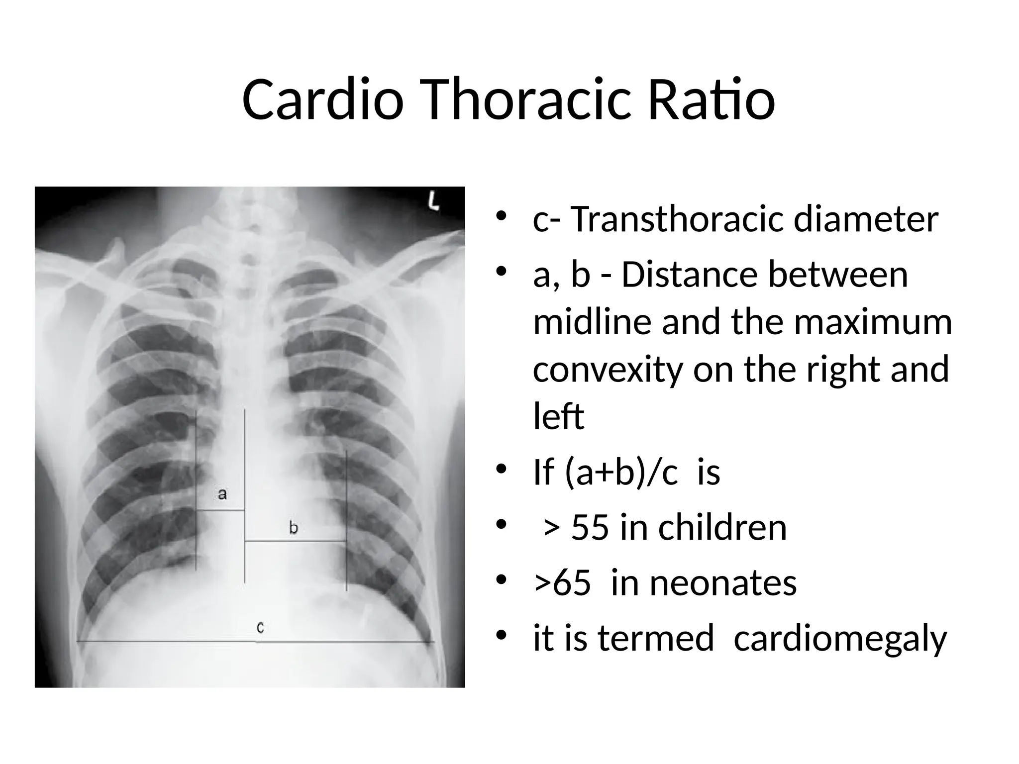 Awesome ppt on paediatric surgery x rays | PPT