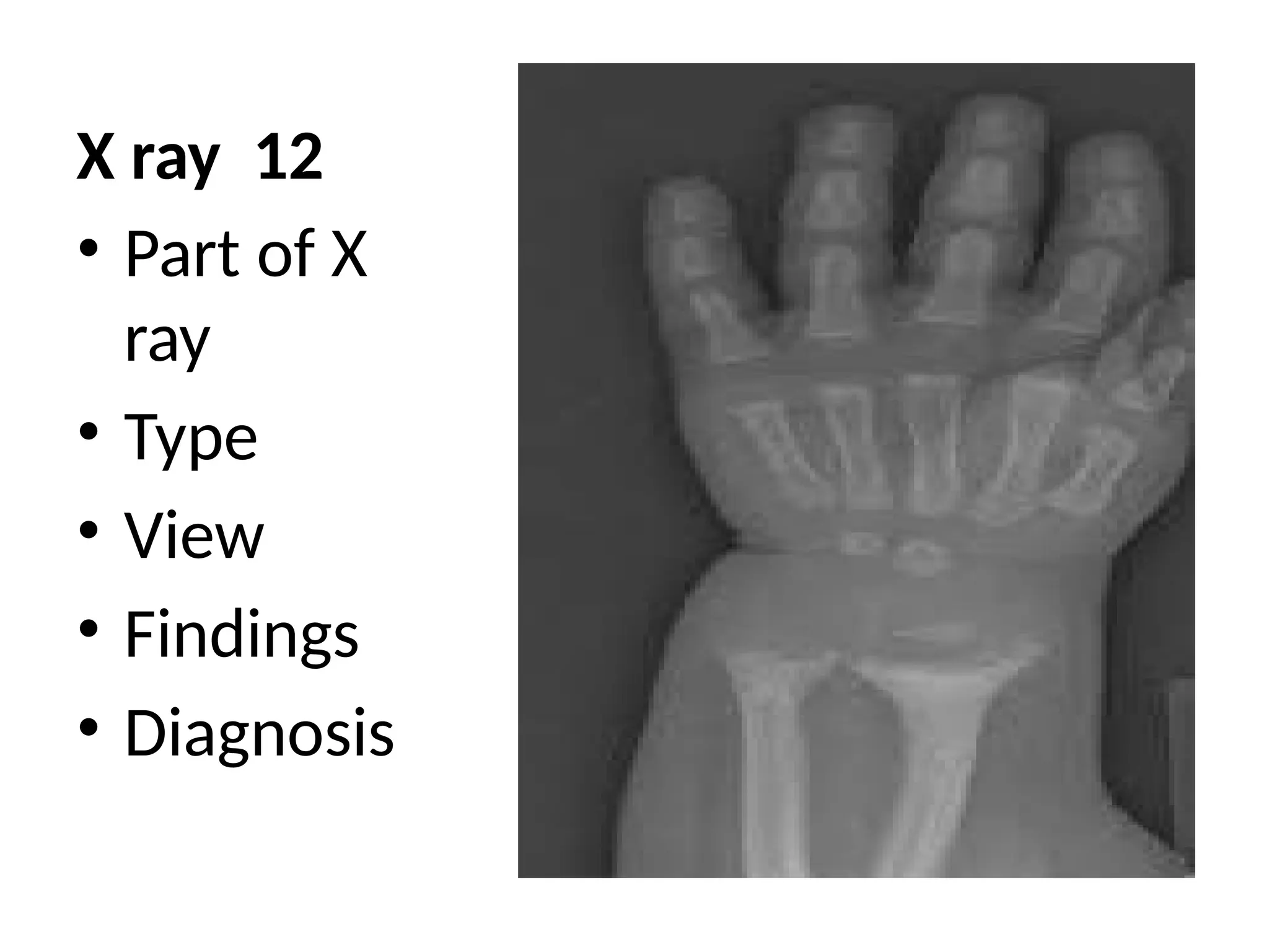 Awesome ppt on paediatric surgery x rays | PPT