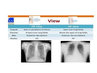 Awesome ppt on paediatric surgery x rays | PPT