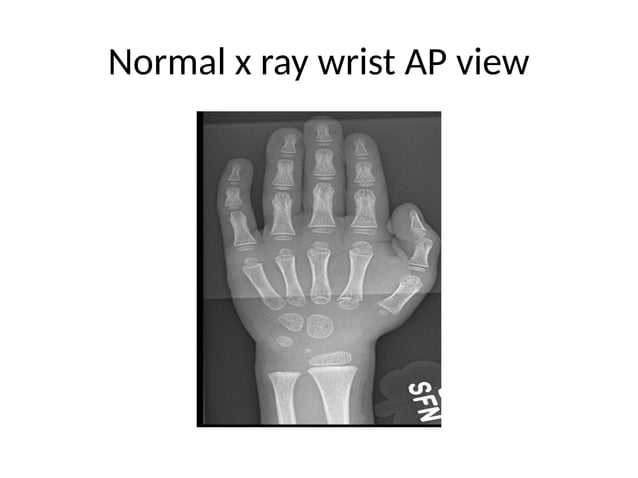 Awesome ppt on paediatric surgery x rays | PPT