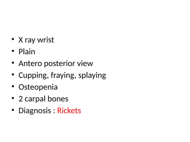 Awesome ppt on paediatric surgery x rays | PPT