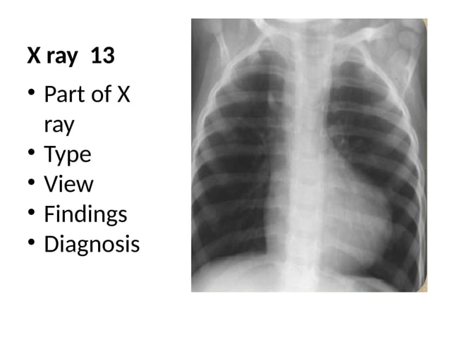Awesome ppt on paediatric surgery x rays | PPT