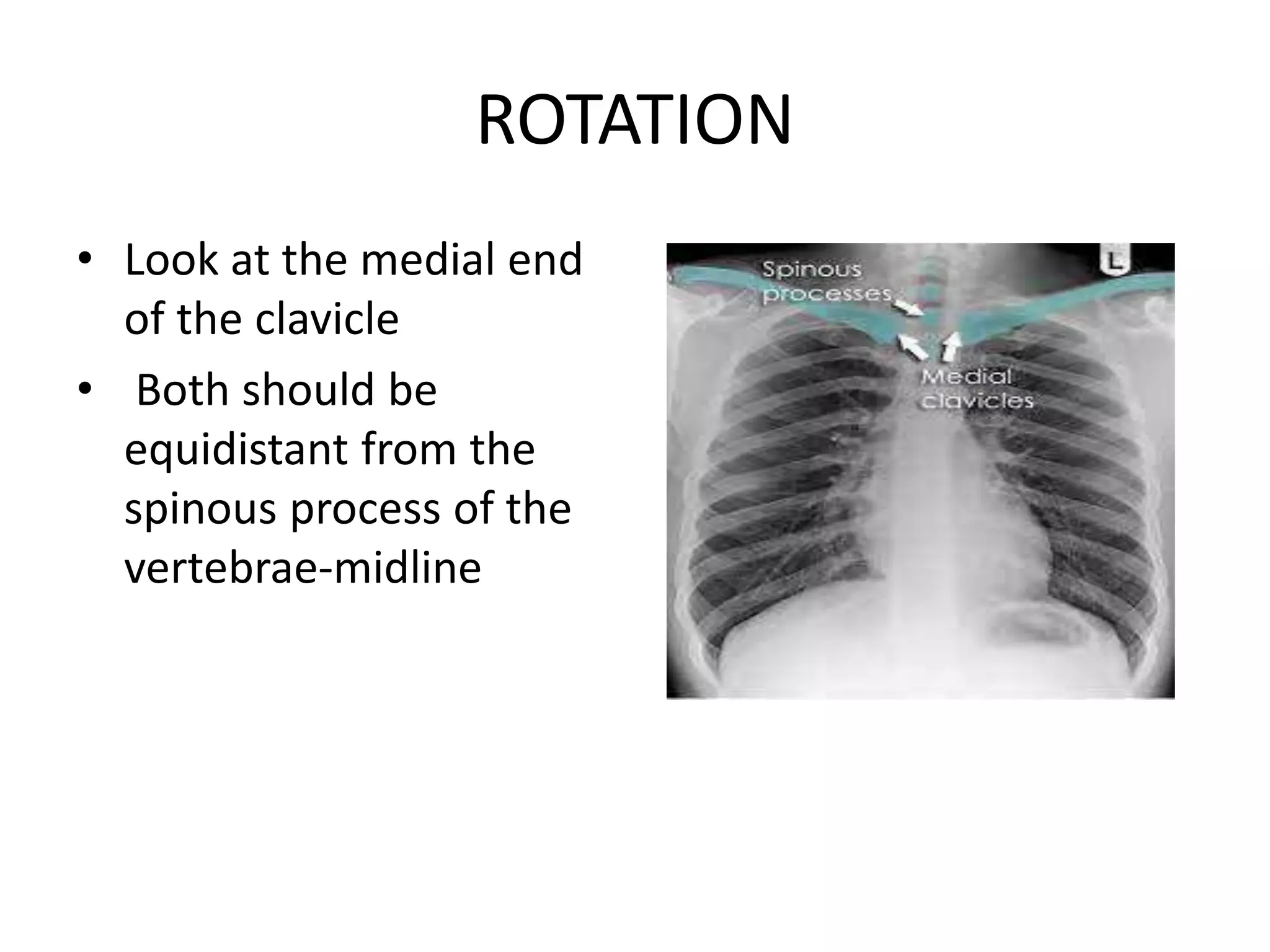 final year X rays viva.pptx
