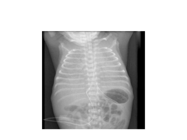 final year X rays viva.pptx