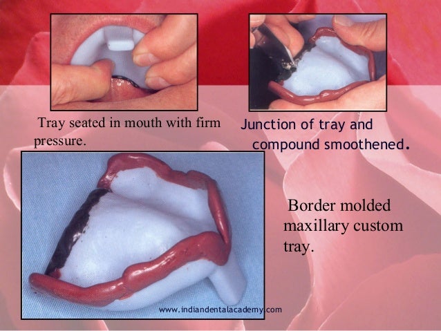 Techniques of dental impression making/ dental education in india