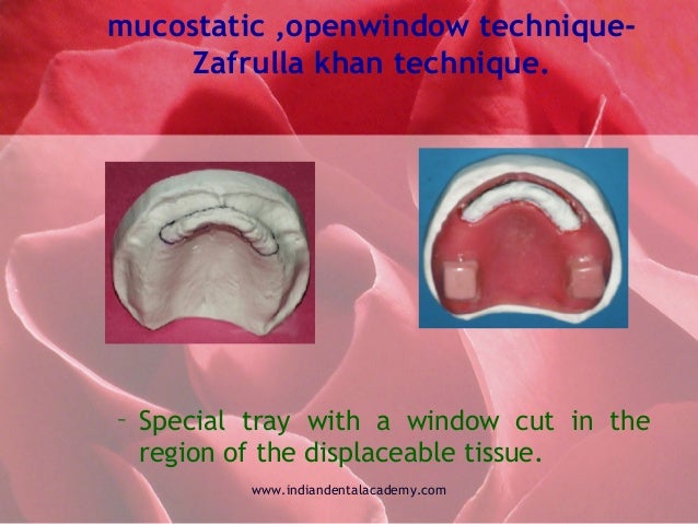 Techniques of dental impression making/ dental education in india