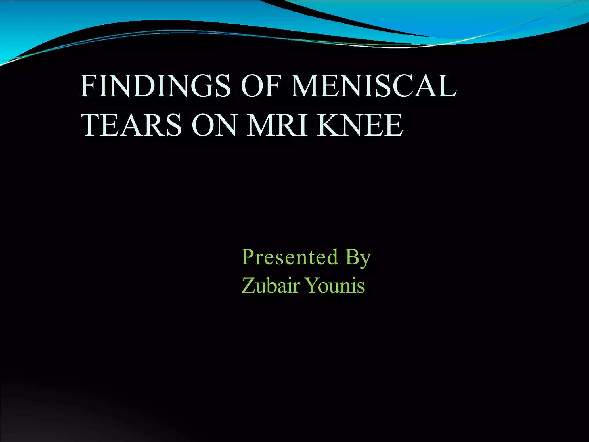Findings of meniscal tears in mri knee | PPTX