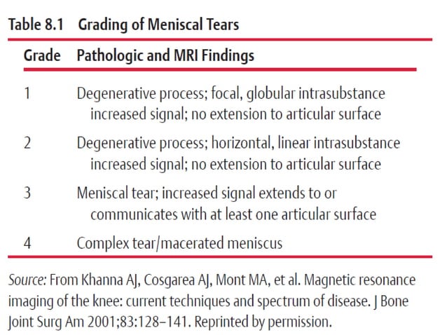 Findings of meniscal tears in mri knee | PPTX