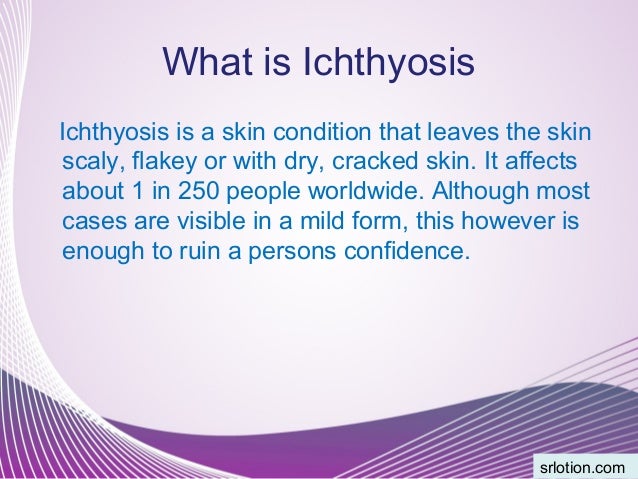 Find the most effective treatment for Ichthyosis