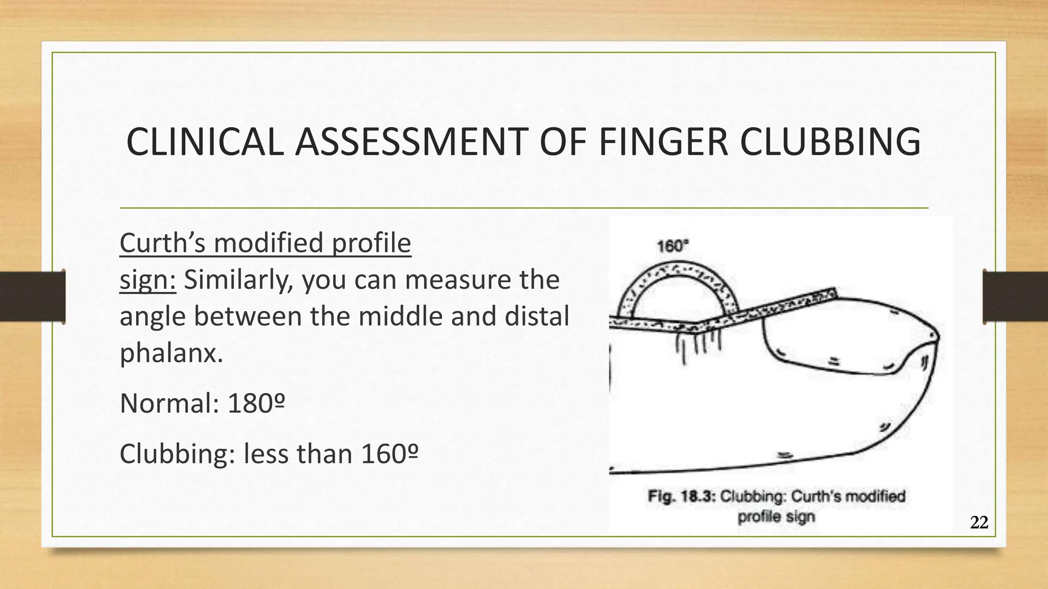 Finger Clubbing by Dr. Samuel2 Alawode.pptx