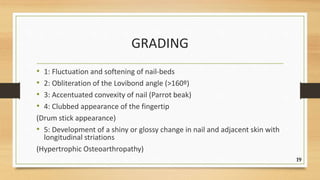 Finger Clubbing by Dr. Samuel2 Alawode.pptx