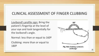 Finger Clubbing by Dr. Samuel2 Alawode.pptx