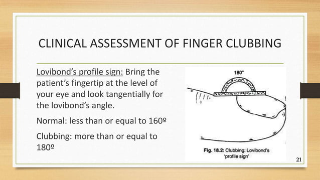 Finger Clubbing by Dr. Samuel2 Alawode.pptx | Lung and Respiratory ...