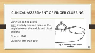 Finger Clubbing by Dr. Samuel2 Alawode.pptx