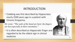 Finger Clubbing by Dr. Samuel2 Alawode.pptx