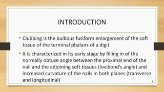 Finger Clubbing by Dr. Samuel2 Alawode.pptx