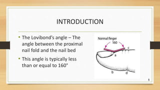Finger Clubbing by Dr. Samuel2 Alawode.pptx