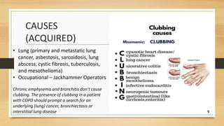 Finger Clubbing by Dr. Samuel2 Alawode.pptx