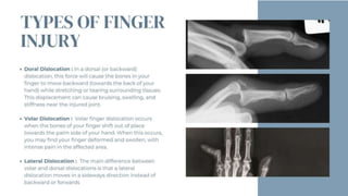 Finger Dislocation Exploring Your Best Treatment Options | PPTX