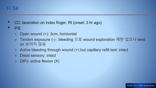 Finger Laceration.pptx