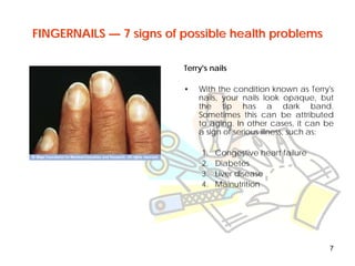 Fingernails | PDF