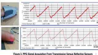 Finger print and pulse sensor for digital signal processors (dsp) | PPTX