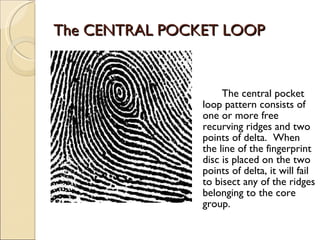 Fingerprint Pattern | PPT