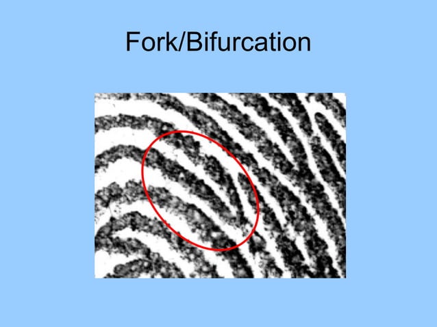 Fingerprints and ridge characteristics | PPT | Skin and Dermatology ...