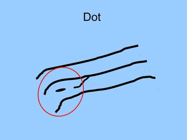 Fingerprints and ridge characteristics | PPT | Skin and Dermatology ...