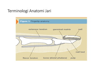 sharing tentang materi Finger Tip Injuries.pptx