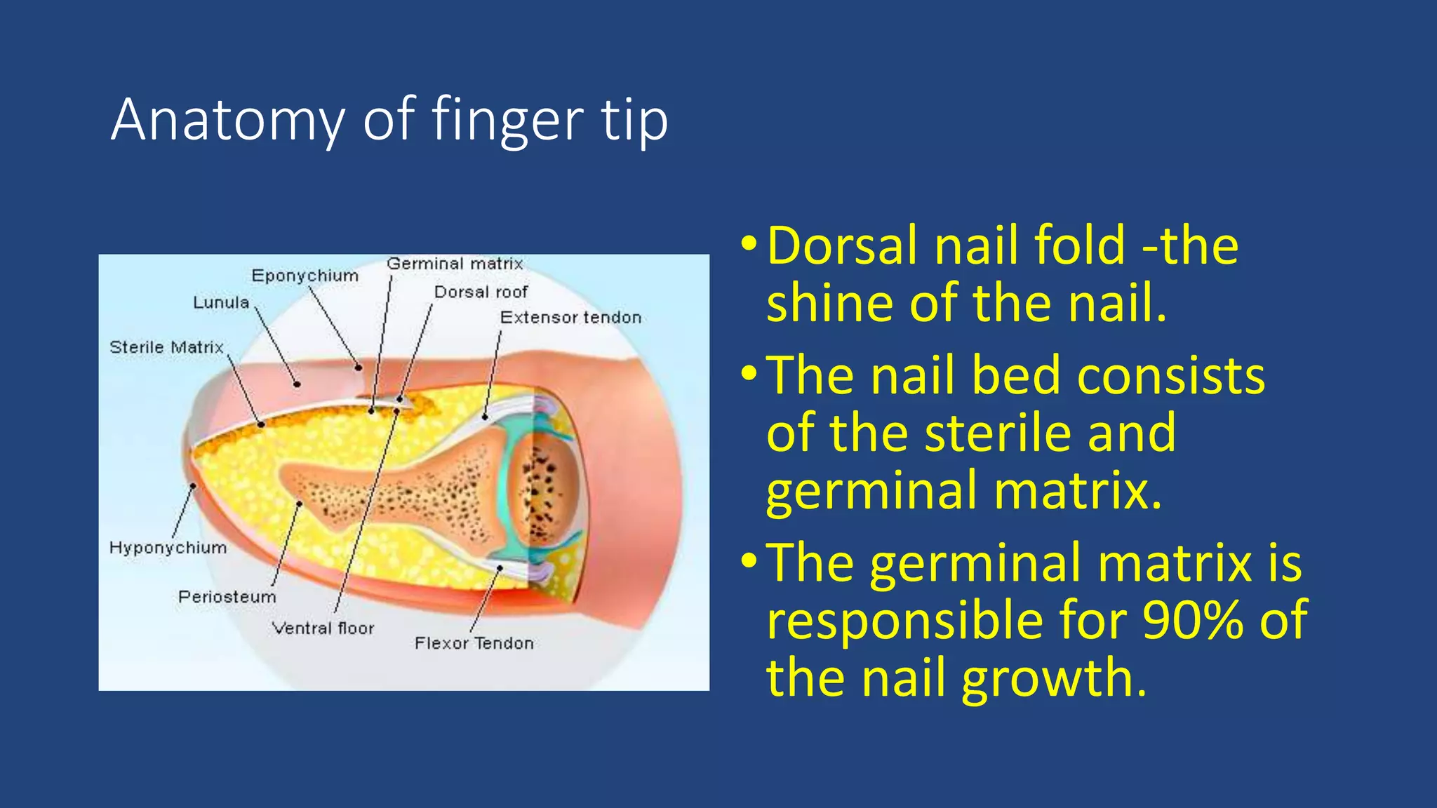 Finger tip injuries in children | PPTX