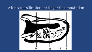 Finger tip injuries in children | PPTX