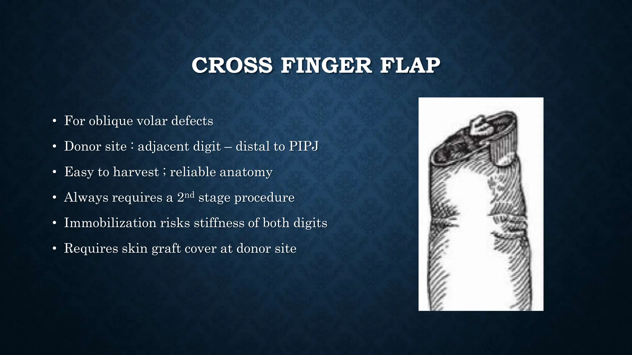 FINGER TIP INJURIES in hand ( plastic surgery).pptx