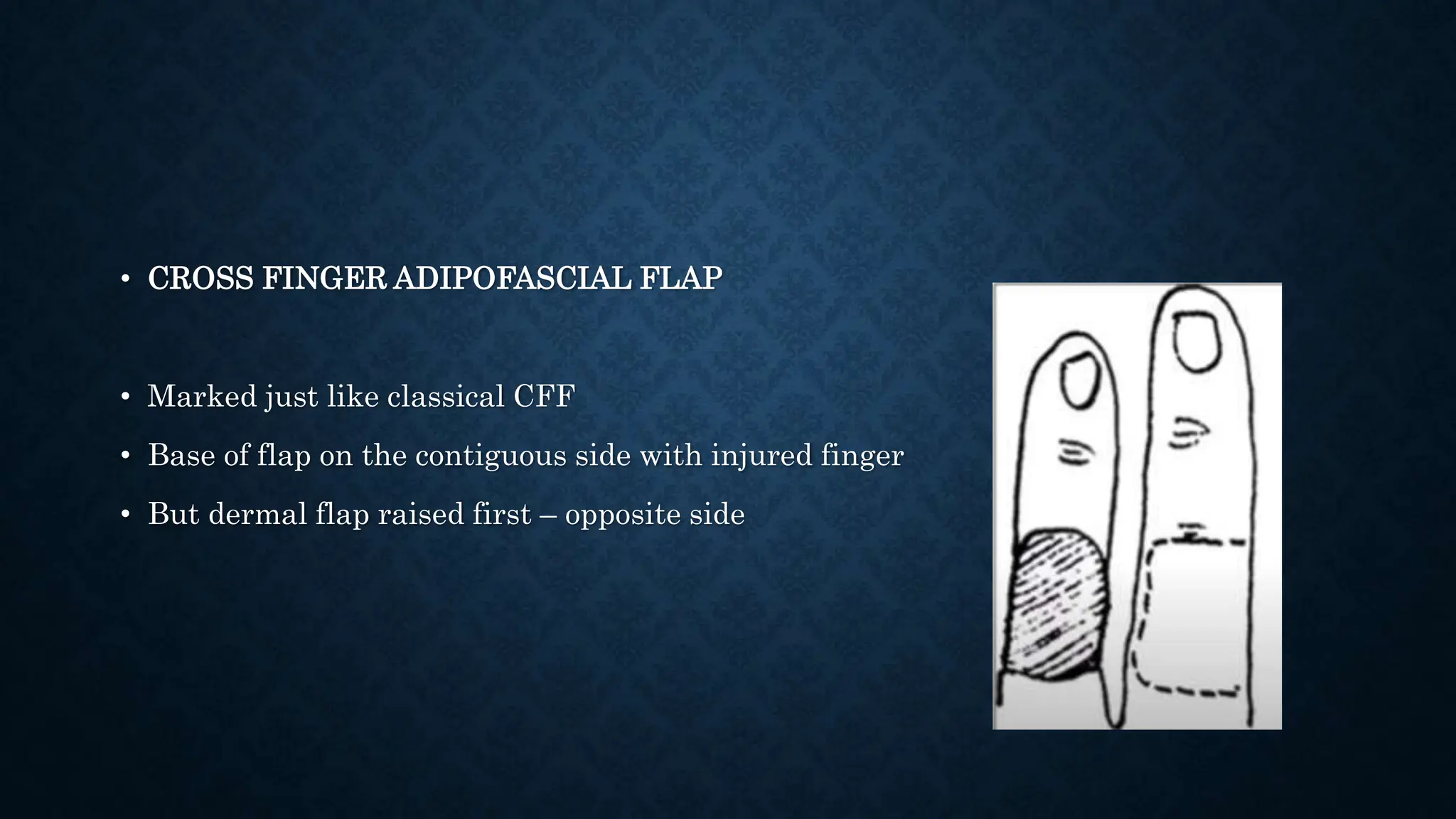 FINGER TIP INJURIES in hand ( plastic surgery).pptx