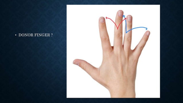 FINGER TIP INJURIES in hand ( plastic surgery).pptx