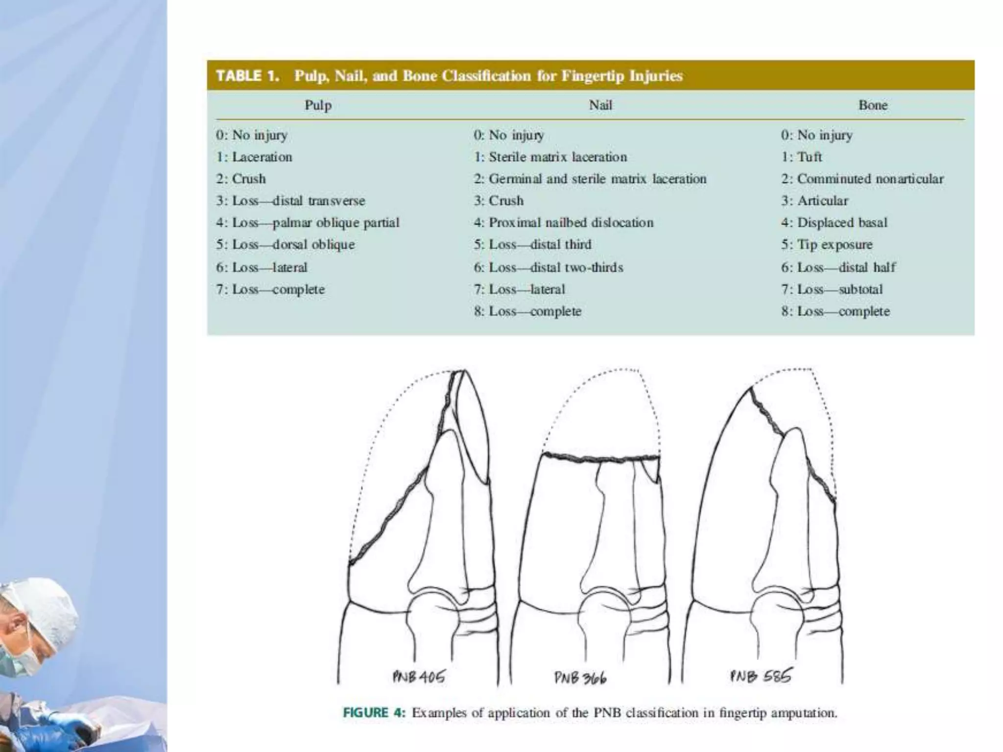 Finger tip injury | PPTX